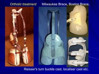 The congenital and acquired diseases of spine | PPT