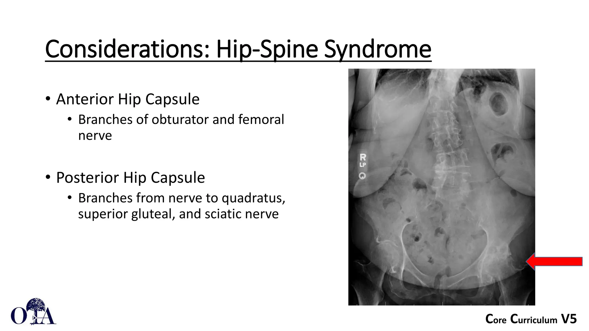 Spine 1 Physical Exam of the spine orthopaedy | PDF