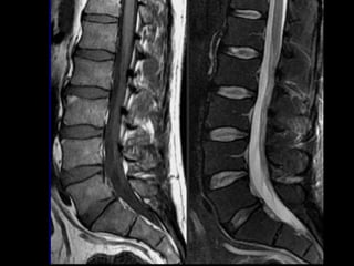 Fejezetek a keresztmetszeti anatómiából - 2. A gerinc anatómiája | PPT ...