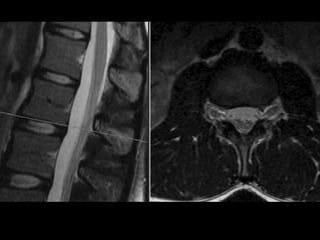 Fejezetek a keresztmetszeti anatómiából - 2. A gerinc anatómiája | PPT