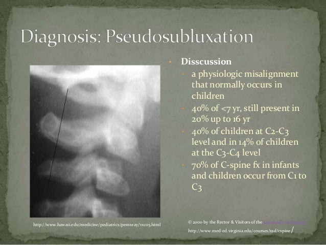 Pseudosubluxation