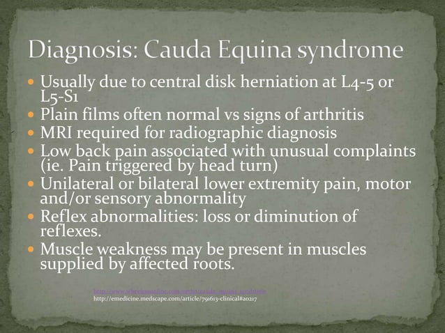 Cauda Equina | PPT