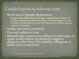 Cauda Equina | PPT