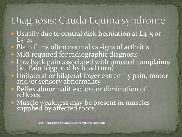 Presentation A Neurological Perspective Of Cauda Equina