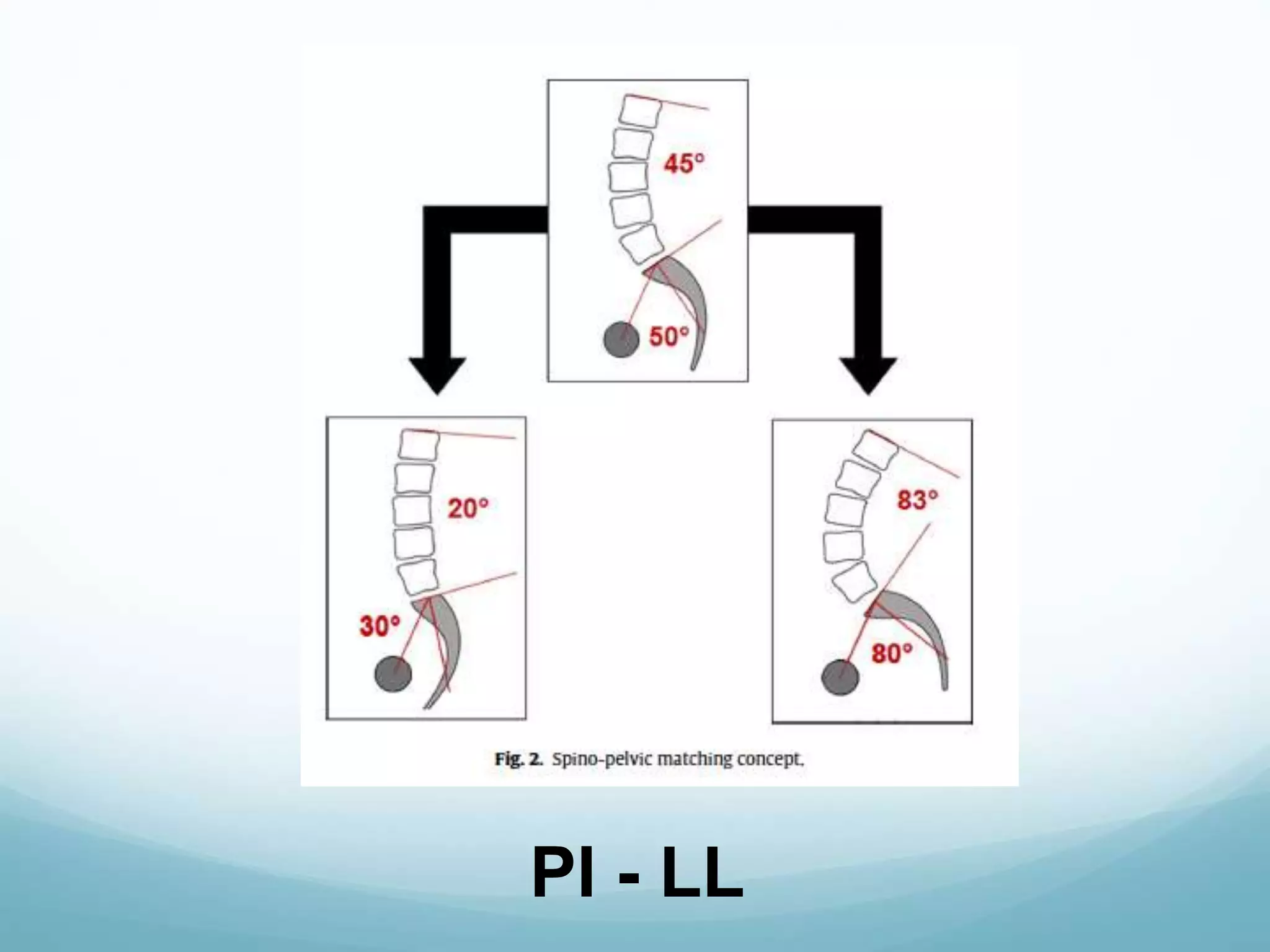 Evaluation of Spinal alignment | PPT
