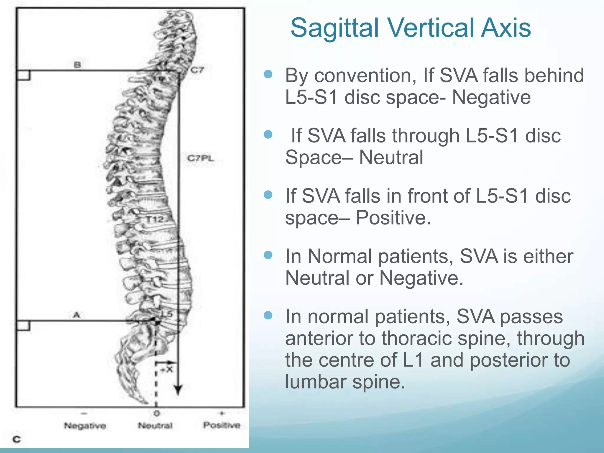 Evaluation of Spinal alignment | PPT
