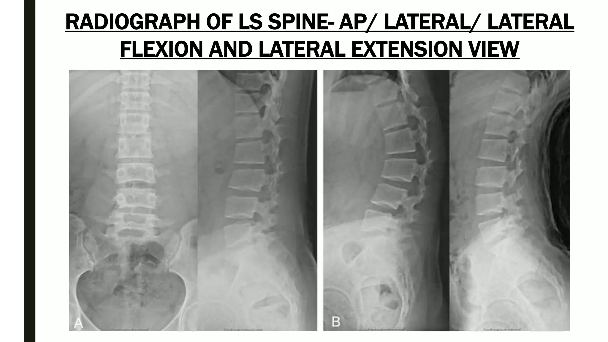 Spine anatomy and xray of spine ppt by Dr Pratik | PPTX