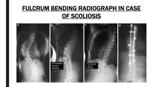 Spine anatomy and xray of spine ppt by Dr Pratik | PPTX
