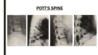 Spine anatomy and xray of spine ppt by Dr Pratik | PPTX