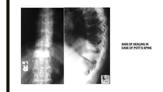 Spine anatomy and xray of spine ppt by Dr Pratik | PPTX