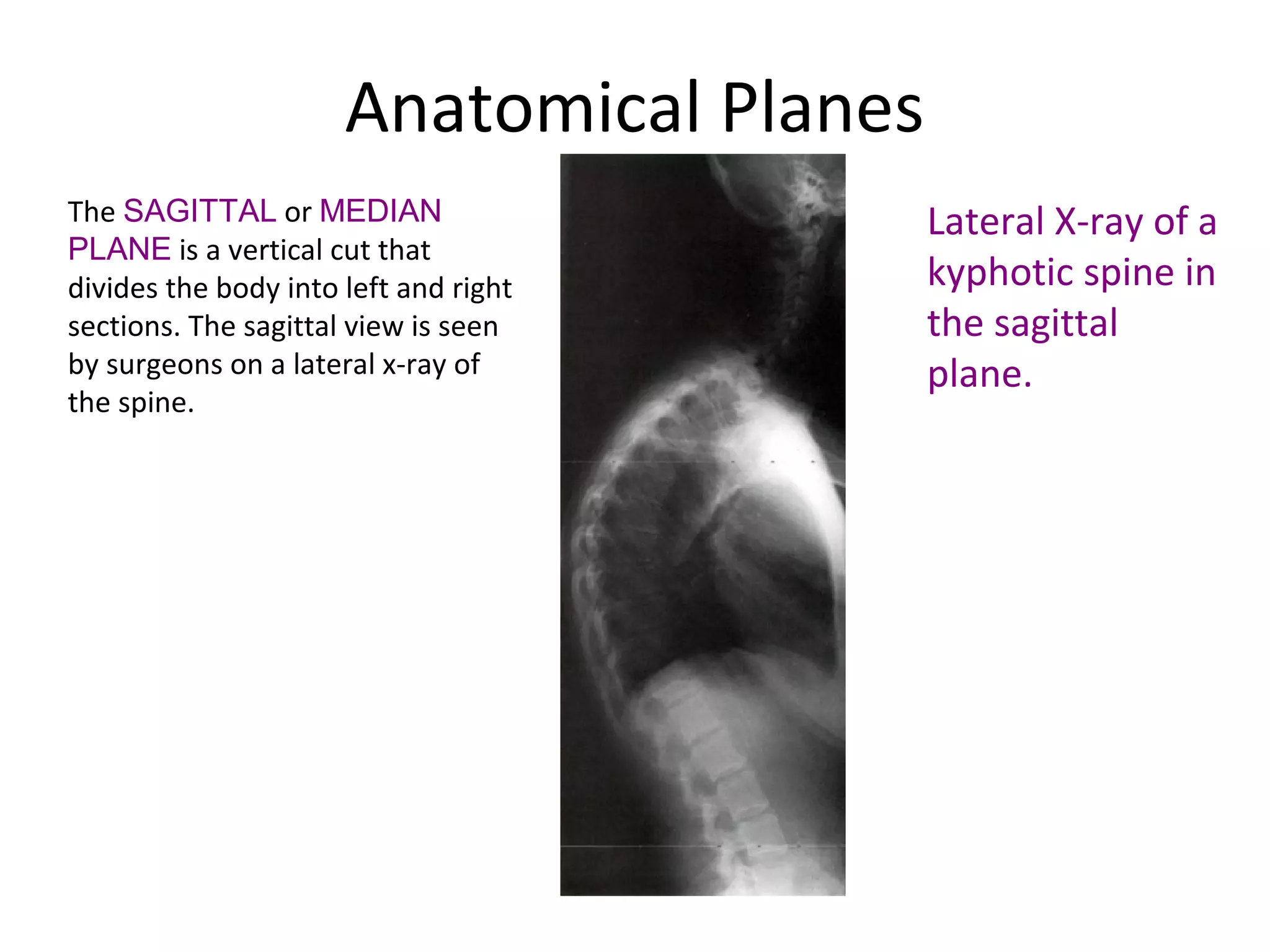 Spine anatomy (basic spine 2009) | PPT