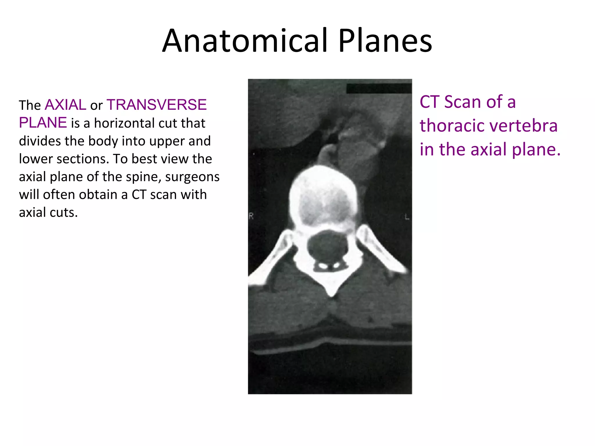 Spine anatomy (basic spine 2009) | PPT