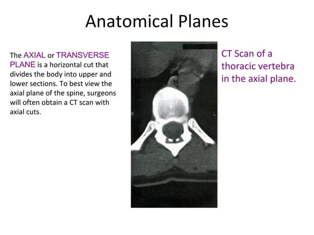 Spine anatomy (basic spine 2009) | PPT | Death, Injury, or Military ...