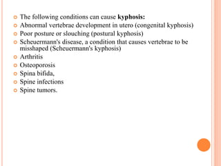 Spine curvature disorders | PPTX