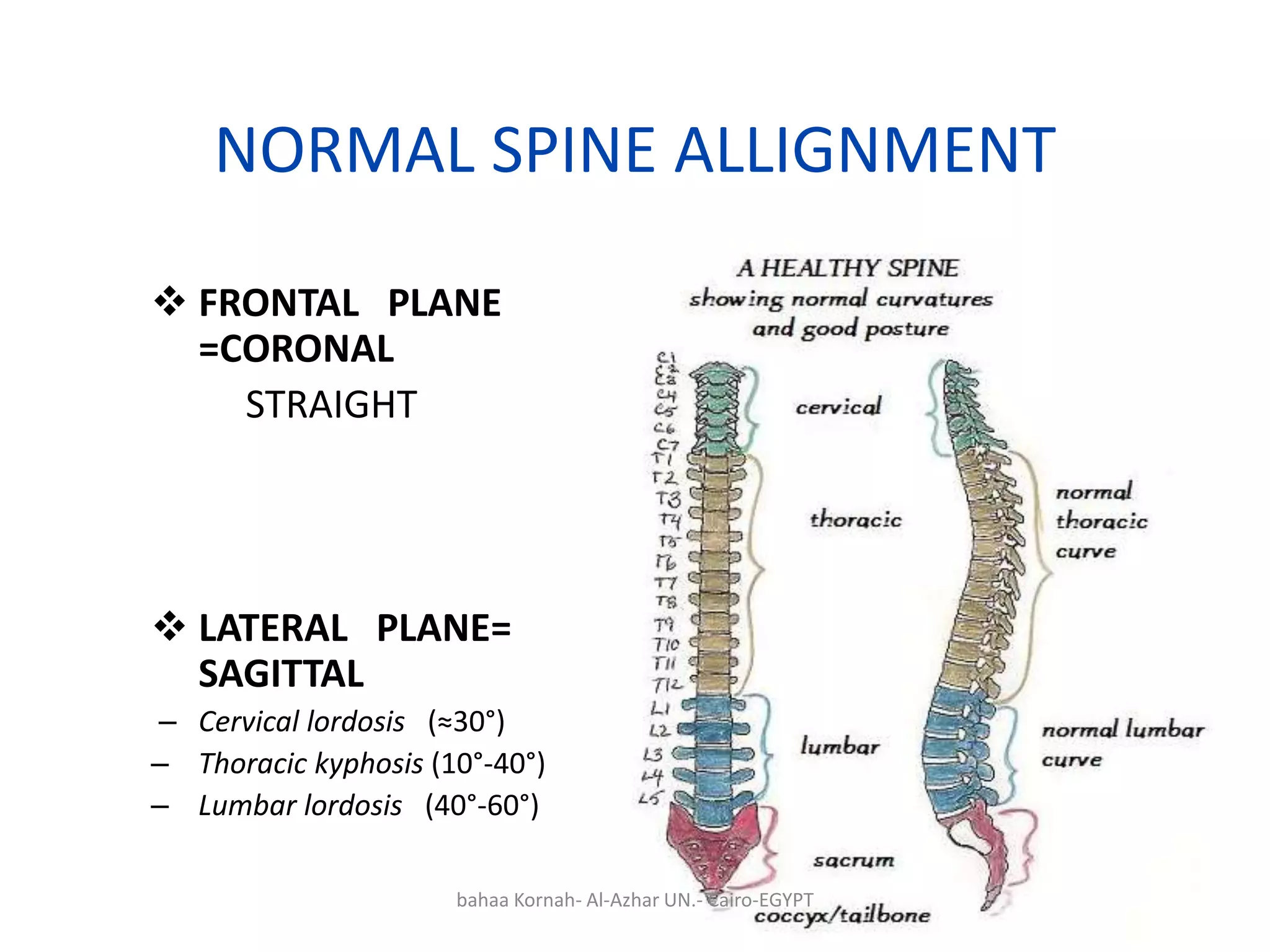 Spine deformities recognition and evaluation | PPT
