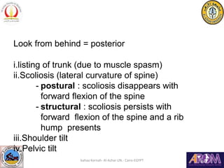 Spine deformities recognition and evaluation | PPT