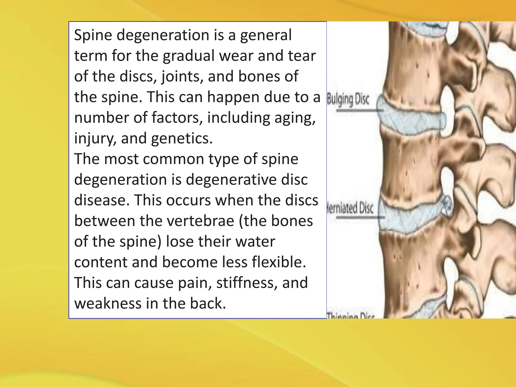 spine degeneration spinal degeneration | PDF