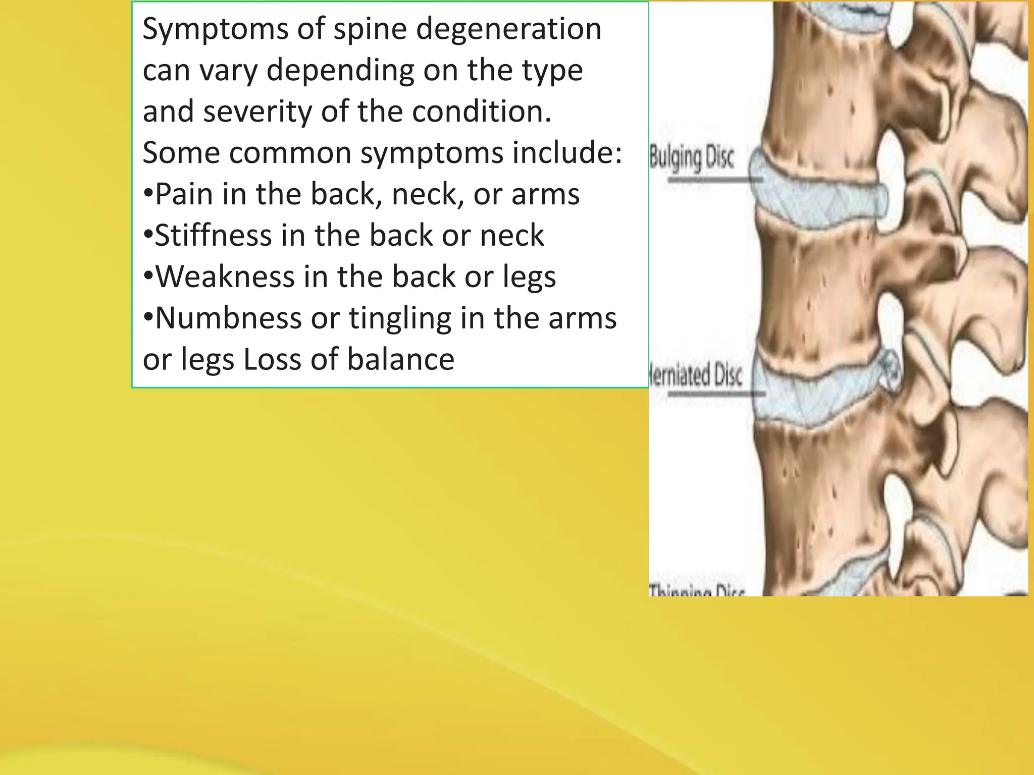 spine degeneration spinal degeneration | PPT