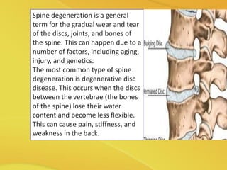 spine degeneration spinal degeneration | PDF