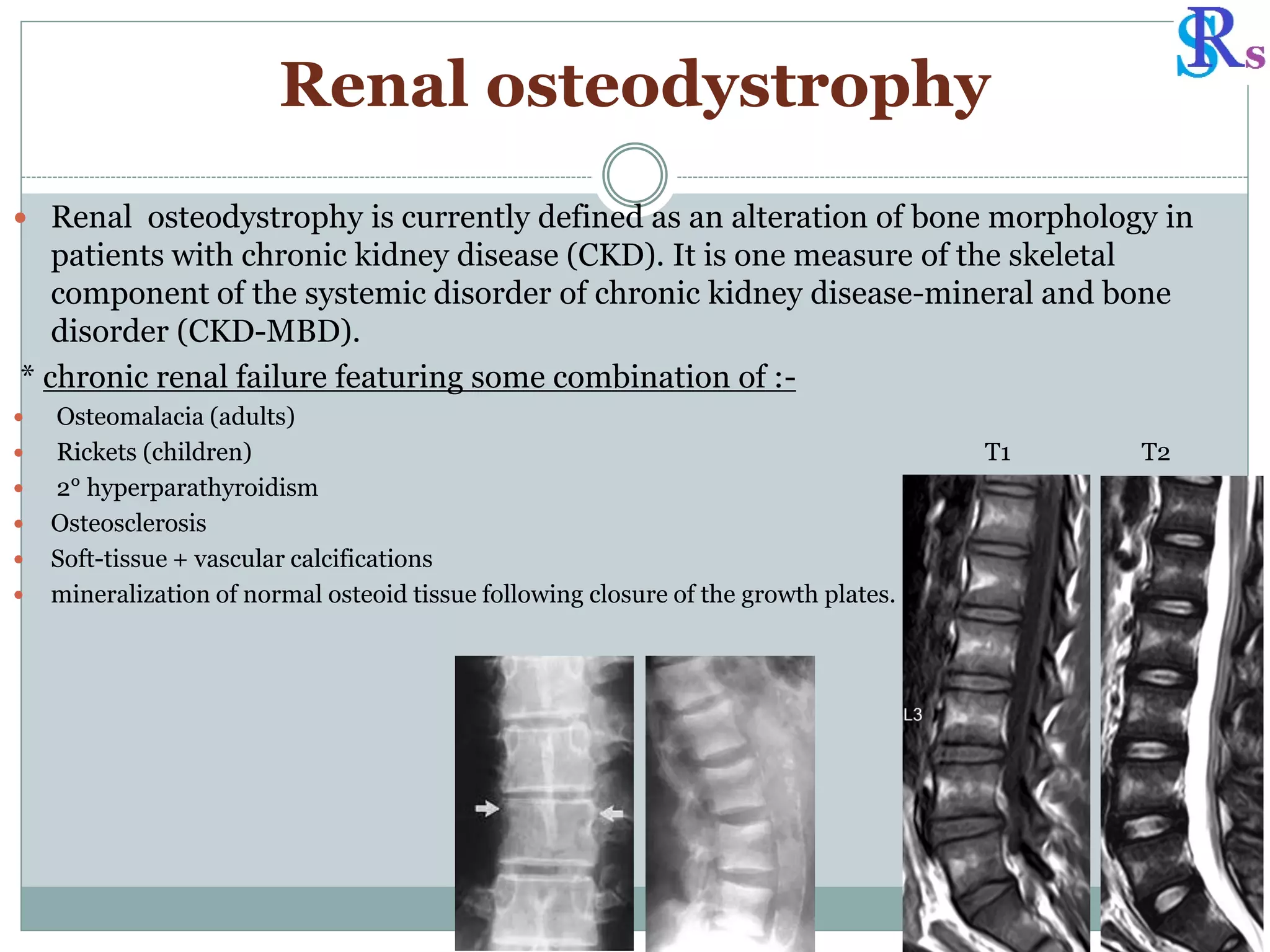 Spine disease e srs update version | PDF