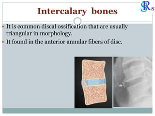 Spine disease e srs update version | PPT