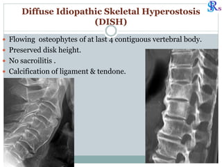 Spine disease | PDF