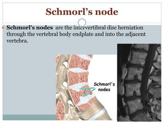 Spine disease in rg finding | PDF