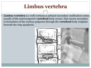 Spine disease in rg finding | PDF