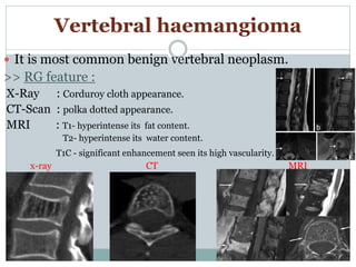 Spine disease in rg finding | PDF