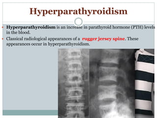 Spine disease in rg finding | PDF