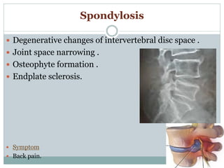 Spine disease in rg finding | PDF