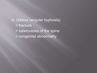 Spine examination | PPTX