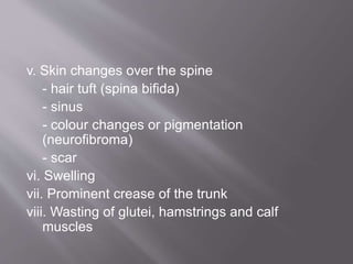 Spine examination | PPTX