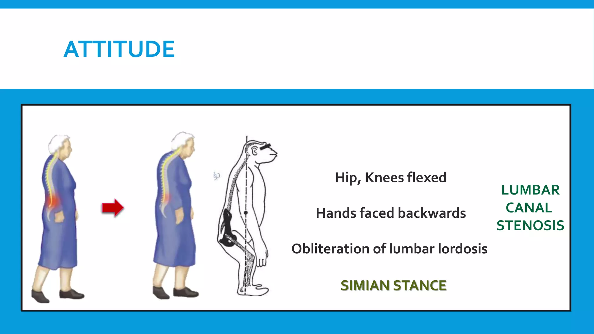 Spine examination- Part 1 | PPTX