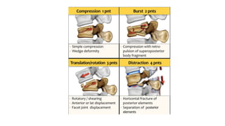 SPINE FRACTURES.pptx