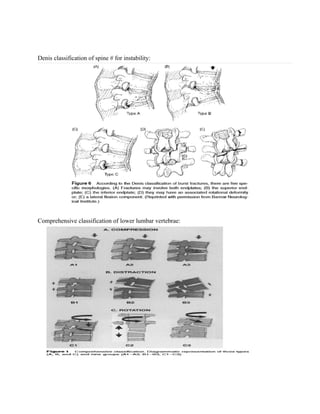Spine fractures _c-t-l-s-c_ | PDF
