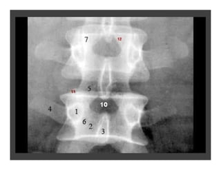 spine imaging.pdf