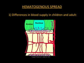 Spine infection | PPT