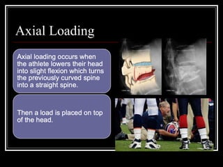 spine Injuries in sports, anatomy, epidemiology, and biomechanic.ppt ...