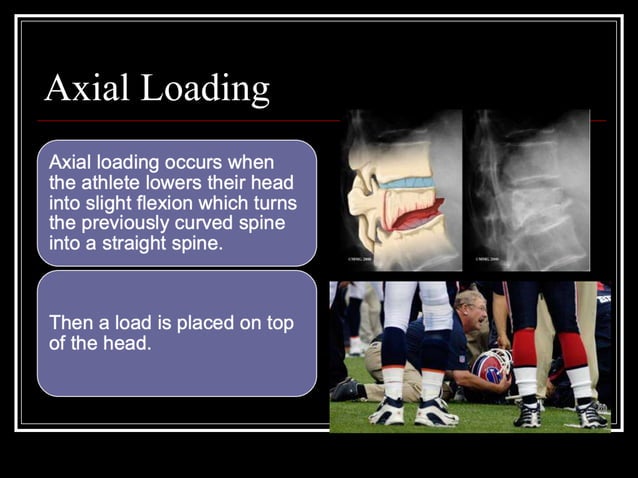 spine Injuries in sports, anatomy, epidemiology, and biomechanic.ppt