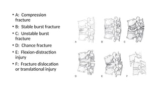 spine injuries thoracolumbar vertebrae fracture | PPTX