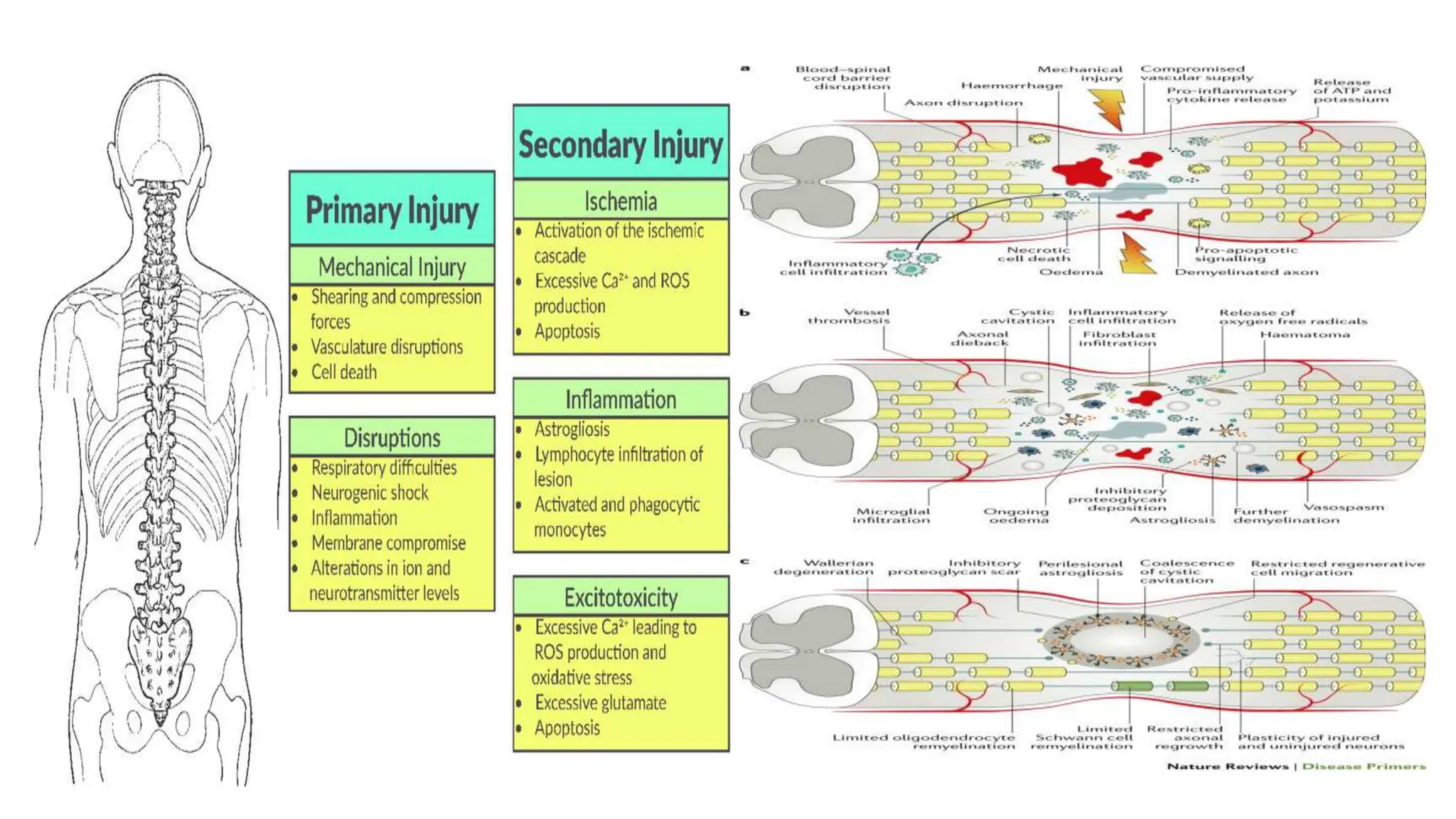 Spine injury according to atls by dr mumtaz ali narejo.pptx