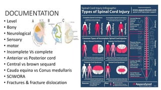 Spine injury according to atls by dr mumtaz ali narejo.pptx | Death, Injury, or Military ...