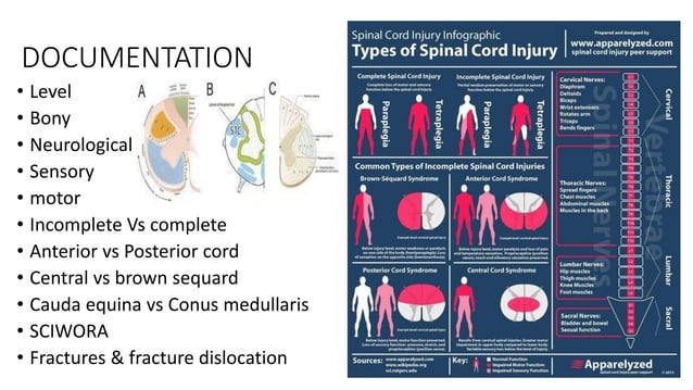 Spine injury according to atls by dr mumtaz ali narejo.pptx | Death ...