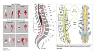 Spine injury according to atls by dr mumtaz ali narejo.pptx | Death ...