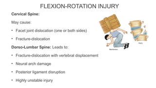 SPINE INJURY MECHANISM AND THEIR CLINICAL FEARURES | PPT