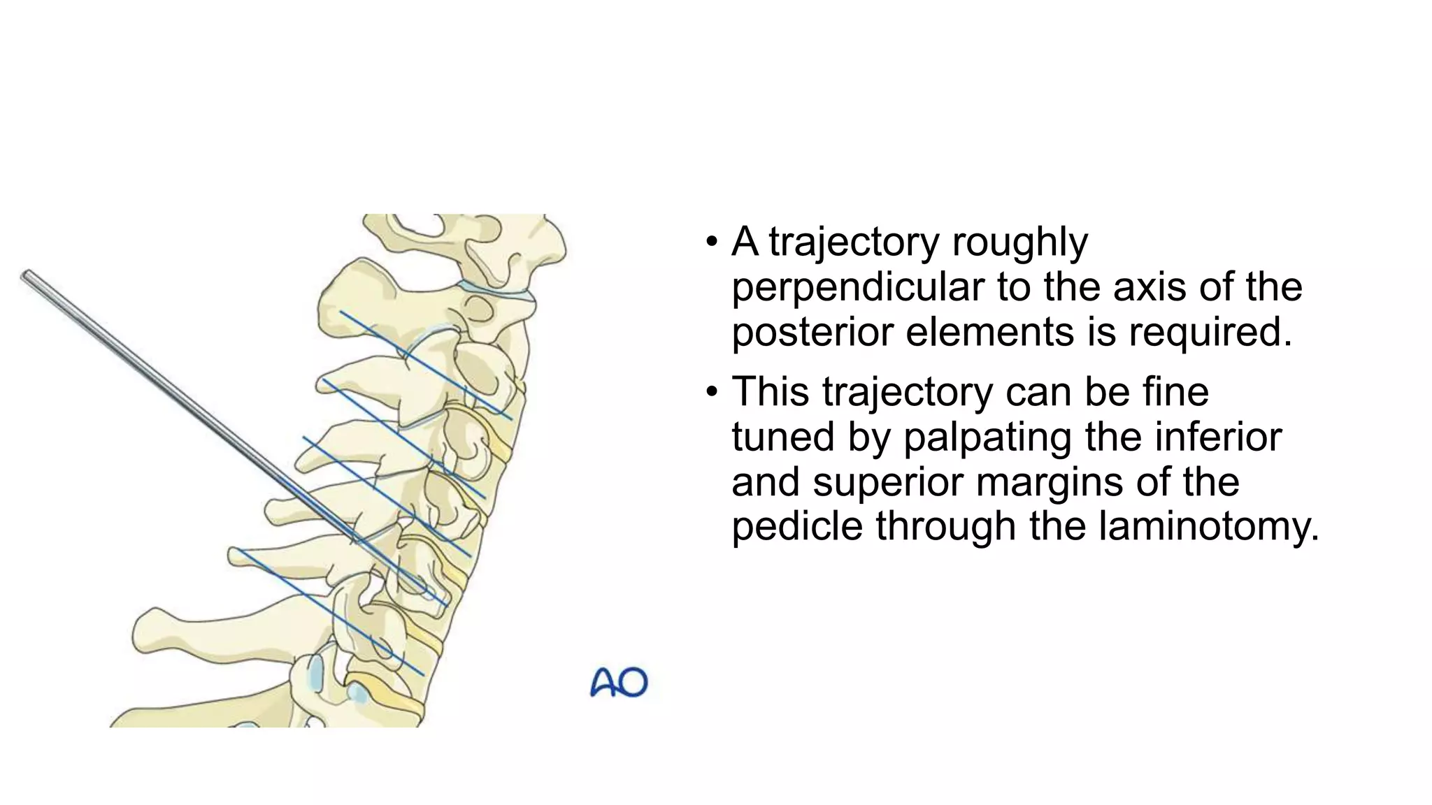 Spine Instrumentation.pptx