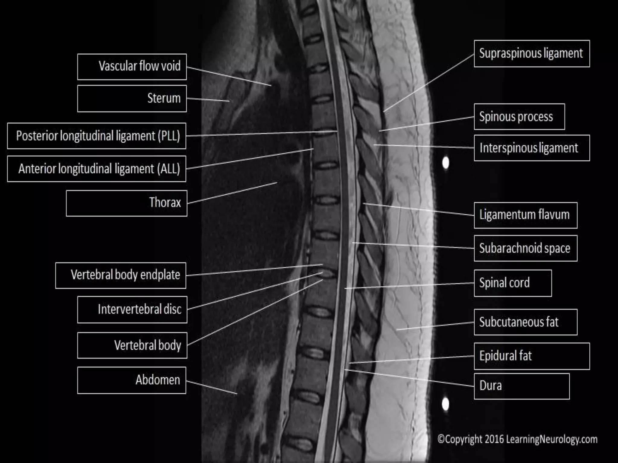 ANATOMY OF MRI SPINE | PPTX