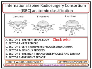 ANATOMY OF MRI SPINE | PPTX