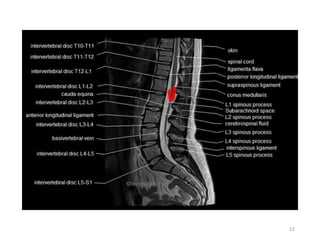 ANATOMY OF MRI SPINE | PPTX